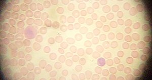 L'observation des cellules sanguines au microscope