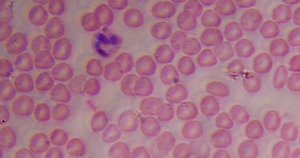 L'observation des cellules sanguines au microscope