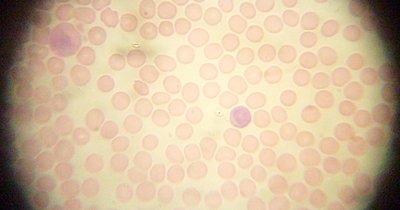 L'observation des cellules sanguines au microscope